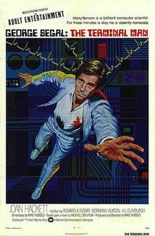 The Terminal Man (1974) – Review | Mana Pop